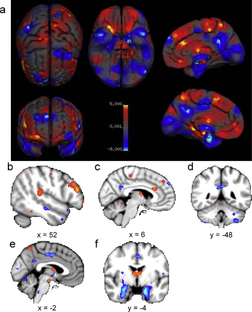 Male And Female Brains The Illustrated Empathy Gap Male And Female Brains The Illustrated Empathy Gap